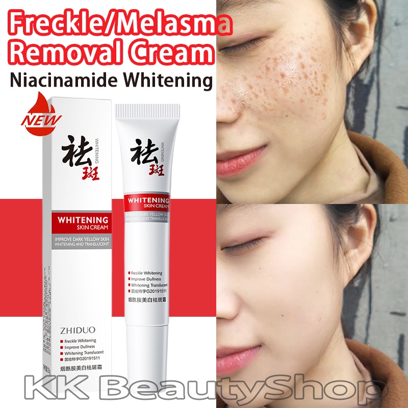 Effective Freckle Removal Cream Whitening Pekas Removal Melasma Dark Spots Brighten Skin Cream ...