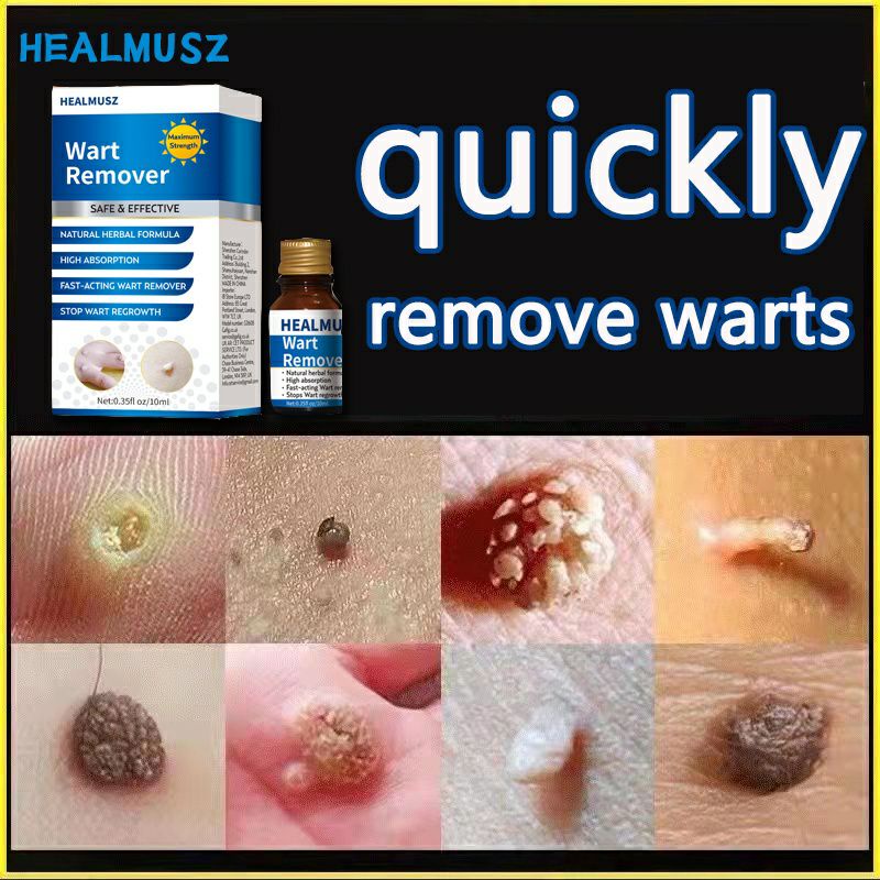 healmusz wart remover original wart remover skin tag treatment cream ...