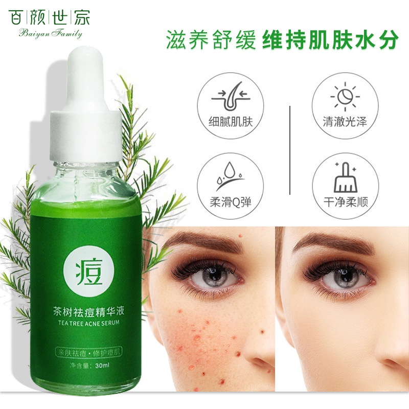 Tea Tree Acne Serum Lighten Acne Marks Dark Spot Pimple Acne Remover ...