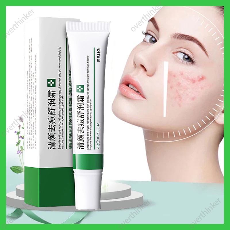 Original Effective Acne Removal Cream Acne Treatment Fade Acne Spots ...