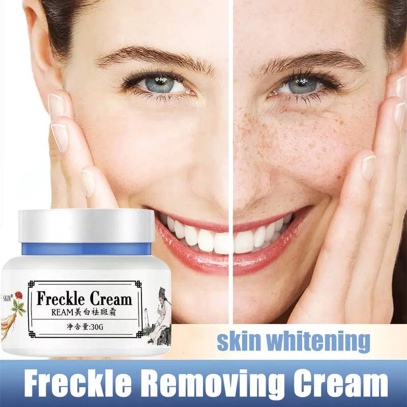 Freckle Removal Cream Whitening Anti-Aging Melasma Removal Dark Spots ...