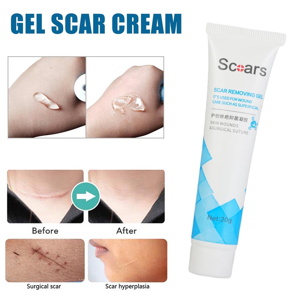 20g Scar Repair Gel Scar Cream Fades Acne Pits Acne Marks Stretch Marks ...