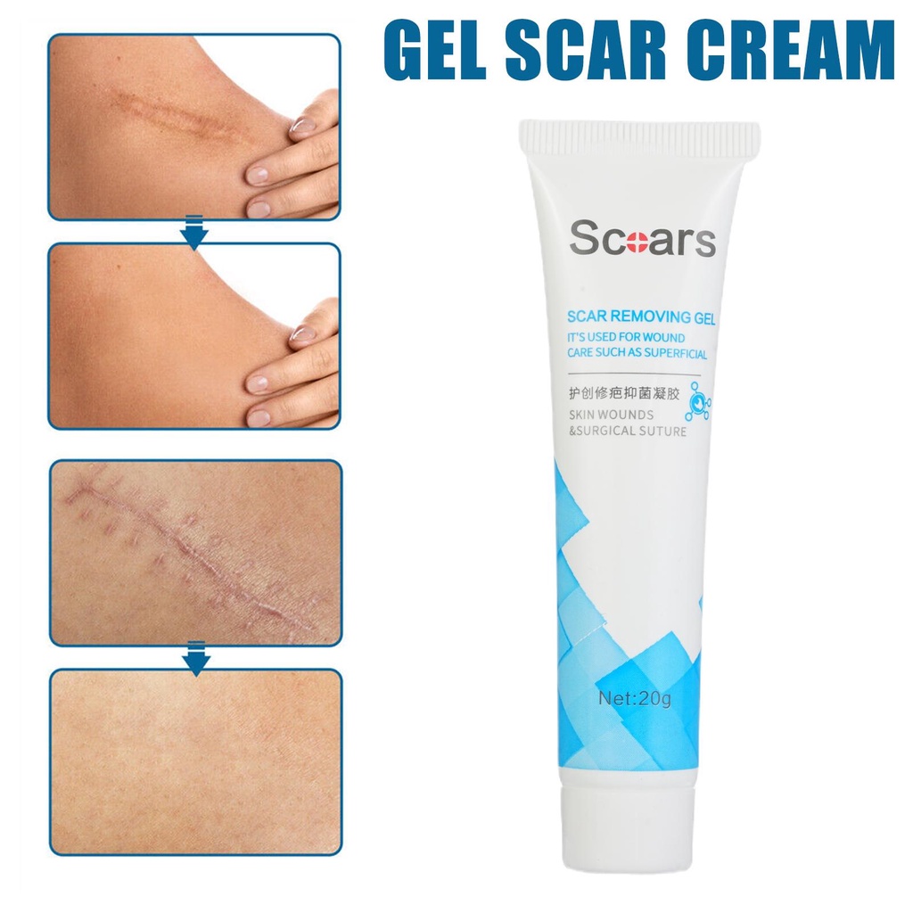 20g Scar Repair Gel Scar Cream Fades Acne Pits Acne Marks Stretch Marks Scar Cream | Shopee ...