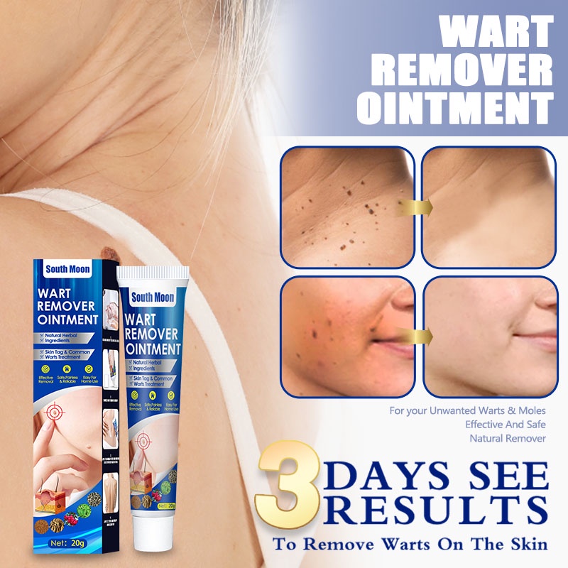 Effective Warts Remover Cream Skin Tag Remover Organic Mole Warts ...