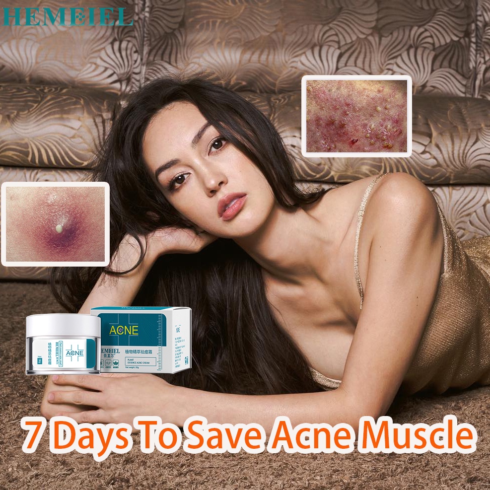 HEMEIEL Pimple Marks Remover Cream / Differin Gel / Effective Pimple ...