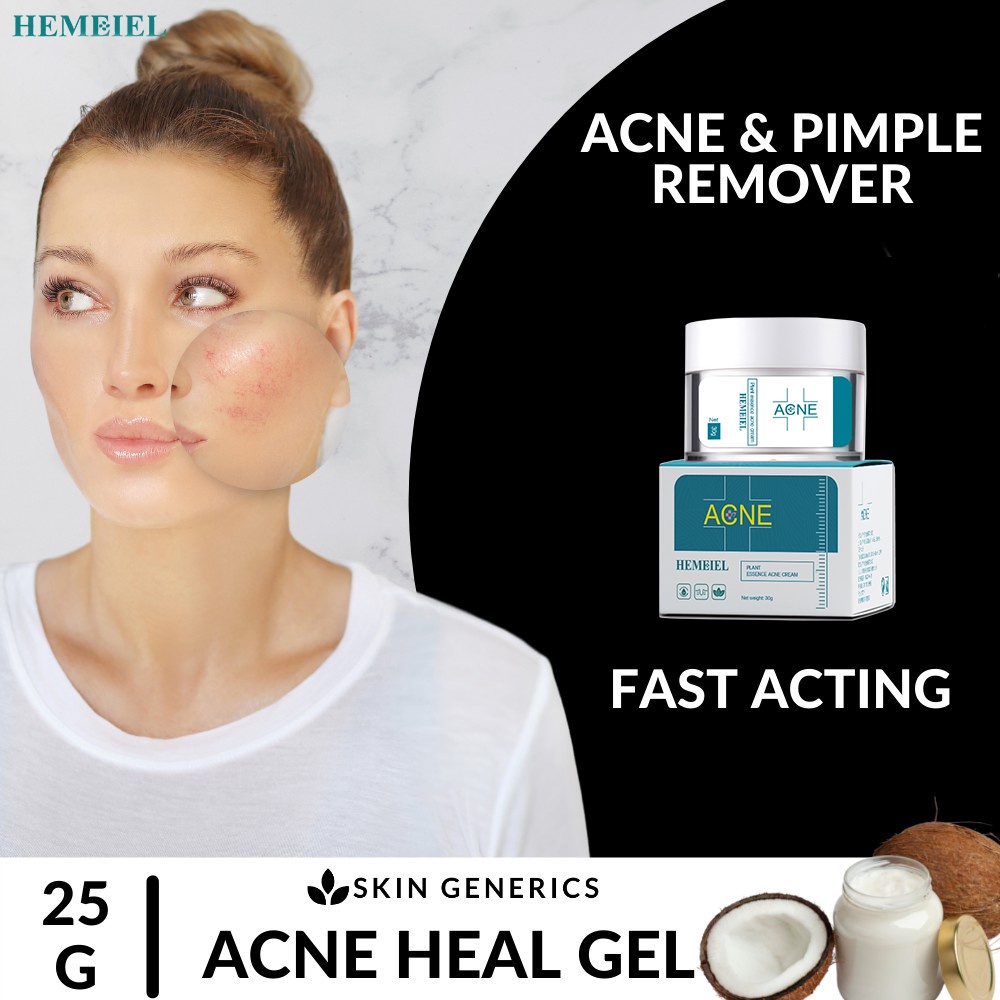 Hemeiel Pimple Marks Remover Cream / Effective Pimple Remover / Acne ...