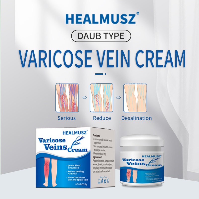 WO&ME Varicose Veins Treatment Cream Ointment For Relieve Blood Stasis ...