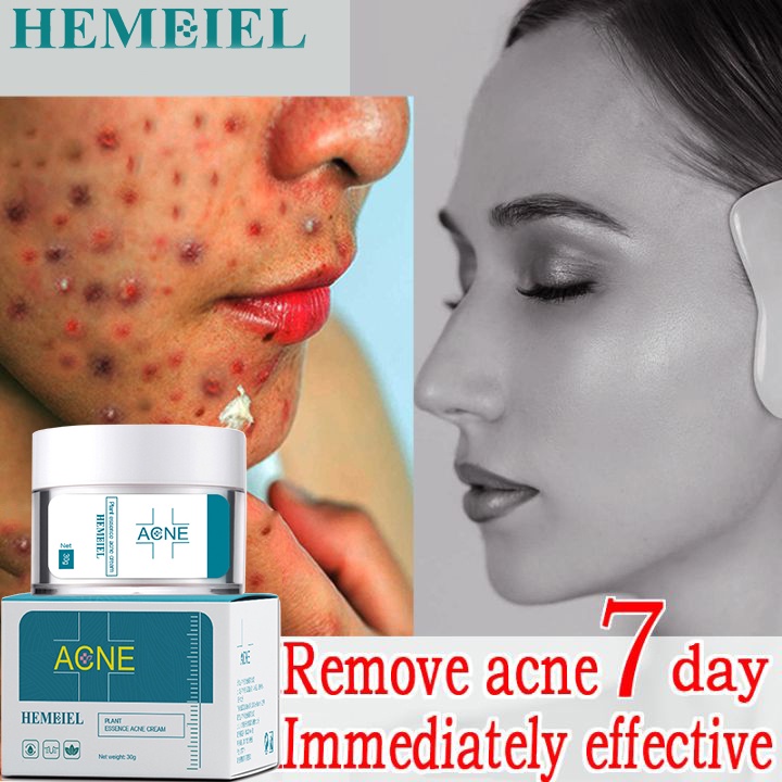 Hemeiel Pimple Marks Remover Cream / Effective Pimple Remover/Acne Scar ...