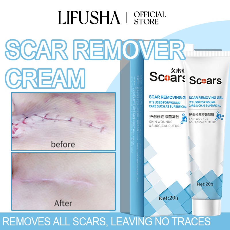 LIFUSHA Scar Removal Cream Peklat Remover Acne Treatment Scar remover ...