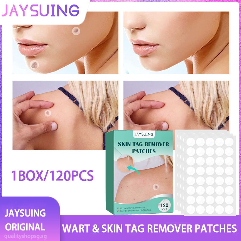 120pcs/Box Warts Remover Original Skin Tag Remover Patch Wart Treatment ...