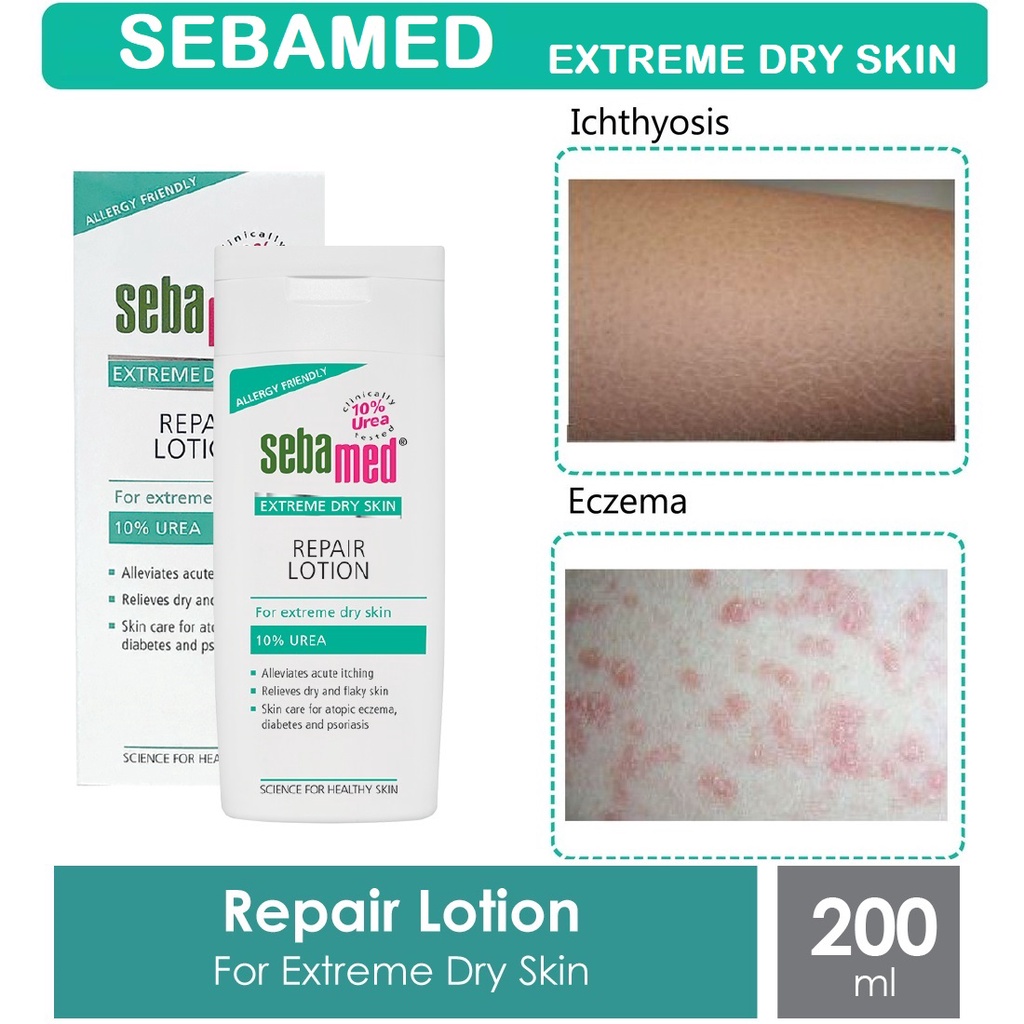 Sebamed Repair lotion For dry skinEXTREME 200ml | Shopee Philippines