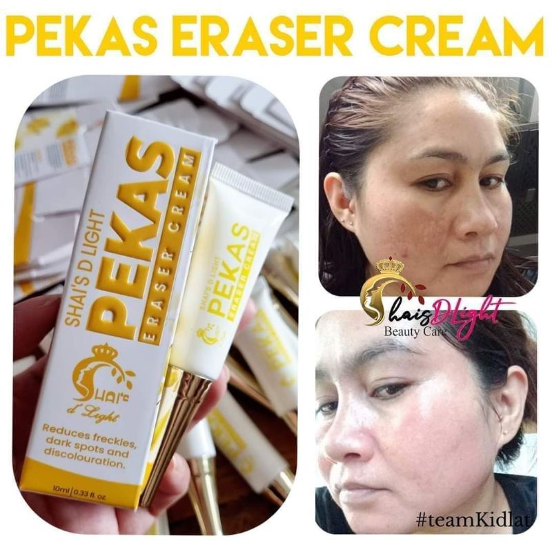 PEKAS/MELASMA REMOVER CREAM 10g | SHAI'SDLIGHT BEAUTY CARE | Shopee ...
