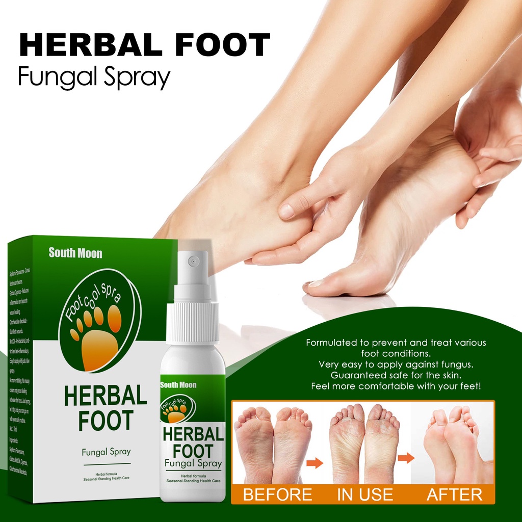 30ml Herbal Foot Spray Feet sweat, foot odor, itching relieving spray ...