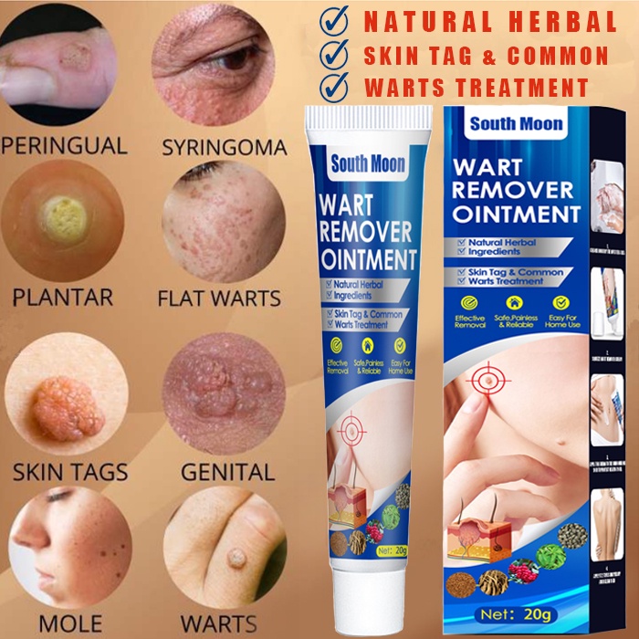 Warts Remover Cream Remove Common Warts Flat Warts Filamentous Warts ...