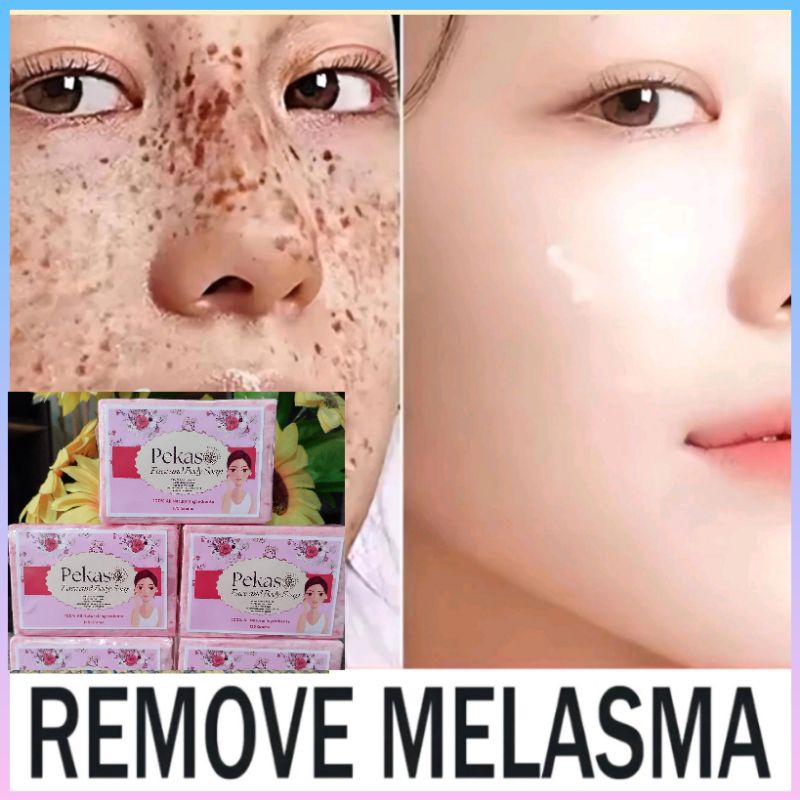 100% ORIGINAL Pekas Remover and whitening Soap 100g | Shopee Philippines