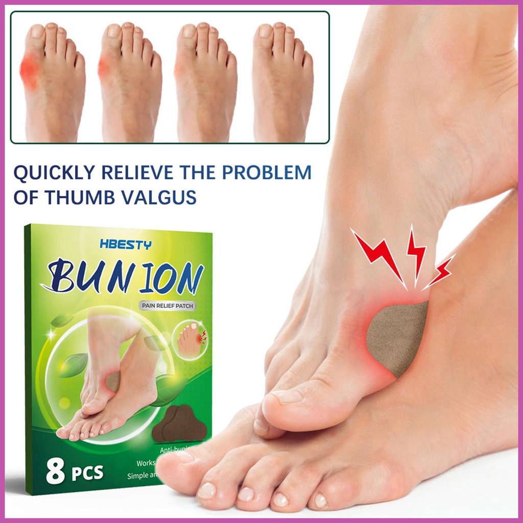 Bunion patch Correcting hallux valgus soothing foot swelling herbal ... Bunion patch Correcting hallux valgus soothing foot swelling herbal ...