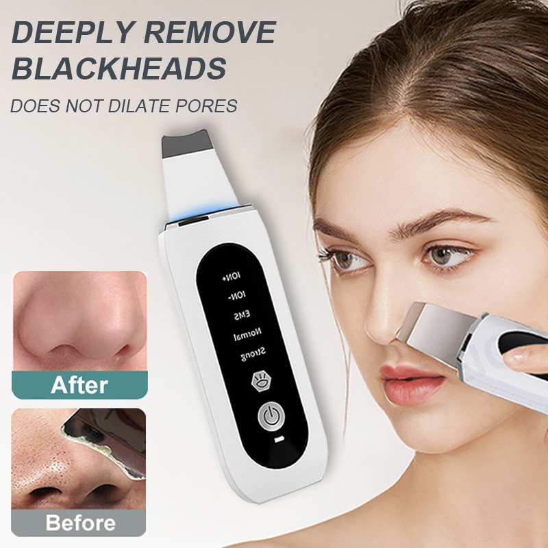 Ultrasonic Skin Scrubber Deep Face Cleaning Machine Facial Pore Cleaner ...