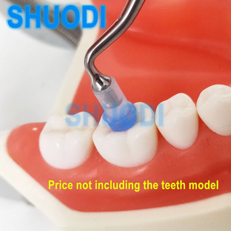 Dental Contact Shape Former with Caps Composite Modelling Instrument ...