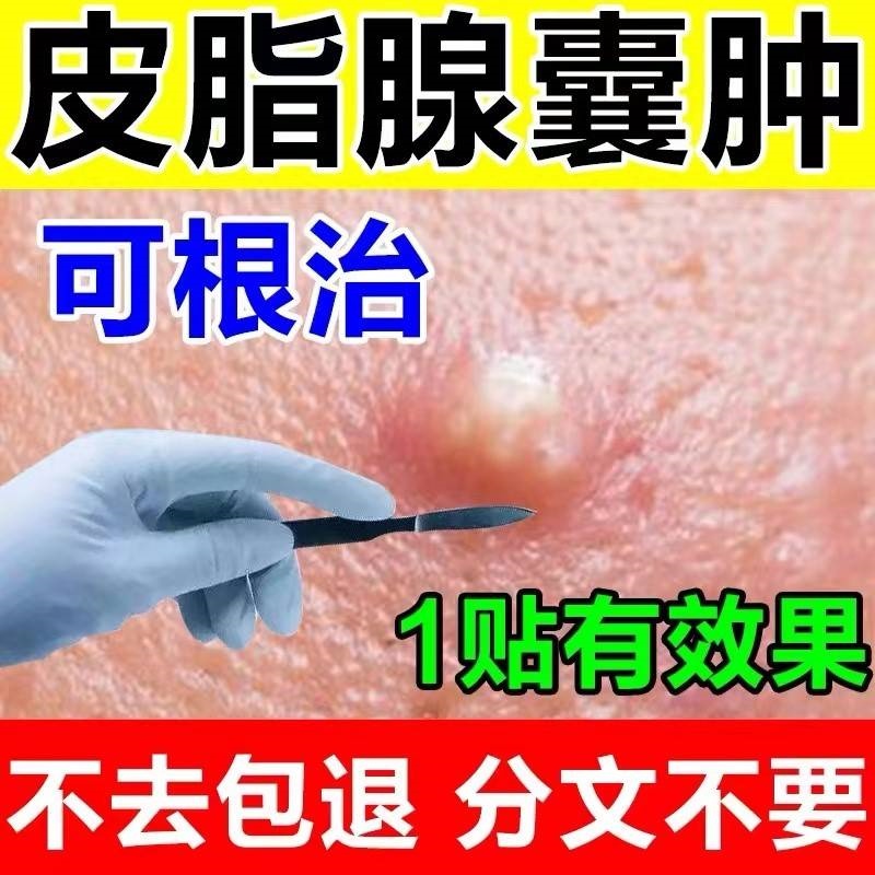 detoxification-sebaceous-cyst-powder-tumor-plaster-patch-for-treatment