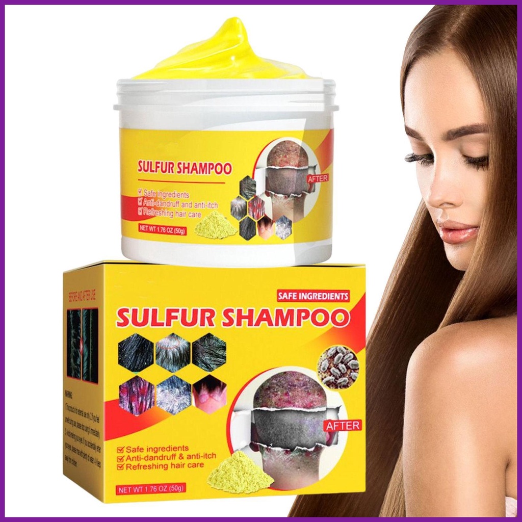 Nourishing Scalp Sulfur Shampoo 50g Anti-itching Control Follicle Scalp ...