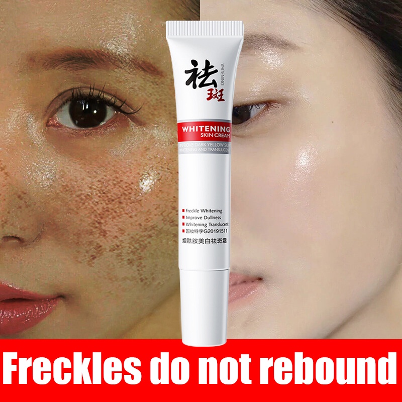 Whitening Freckle Cream Remove Melasma Cream Dark Spots Melanin Remover Brighten Skin Anti-Aging ...