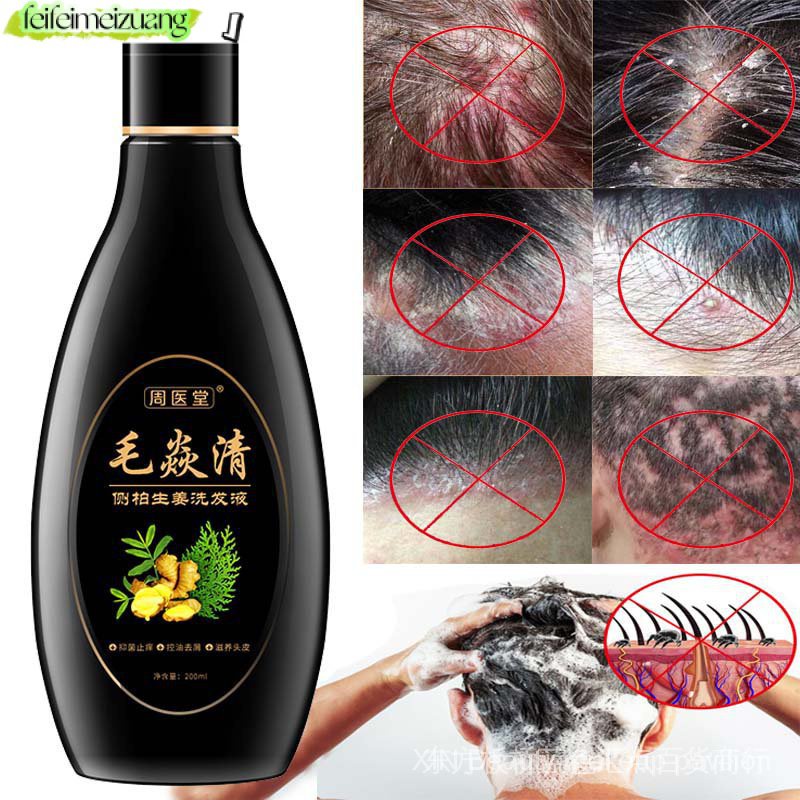 STR scalp folliculitis shampoo anti-dandruff and relieve itching anti-mite oil control anti ...