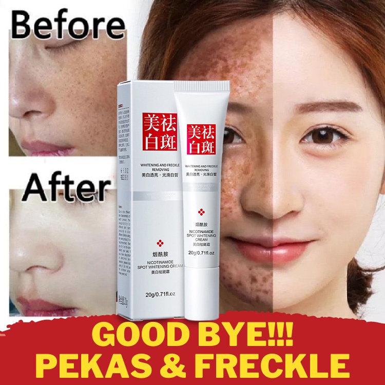 20g Whitening Freckle Cream Melasma Remover Cream Effective Anti ...