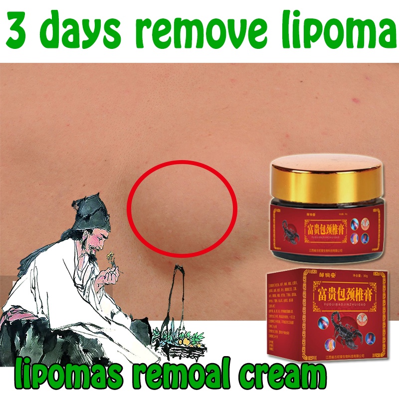 50g lipoma removal cream gamot sa bukol lipoma remover original removal ...