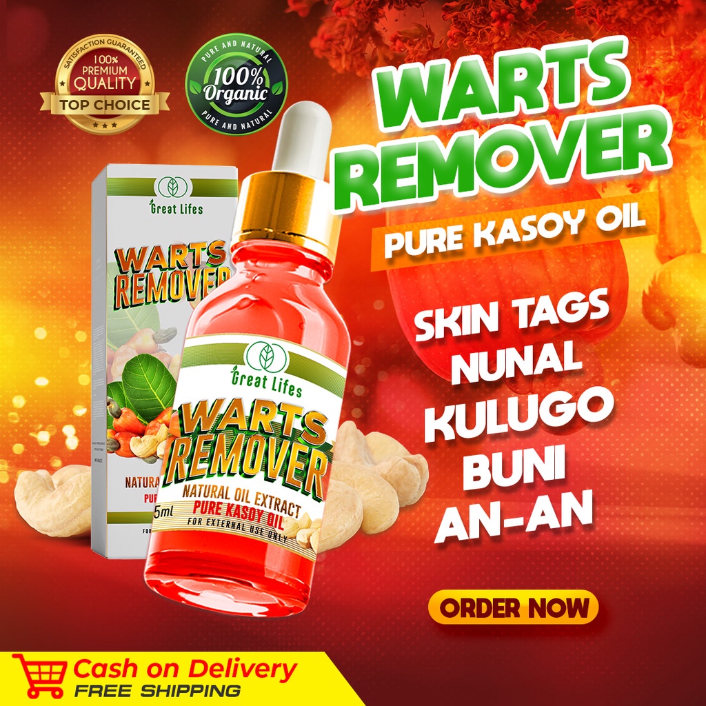 Kasoy Oil Warts Remover Original Effective Skin Tags And Mole Remover ...
