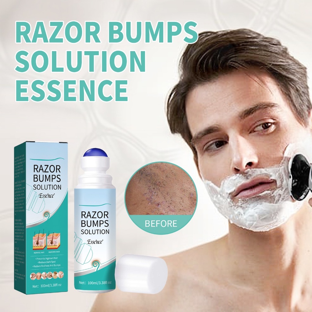 Roll-On Razor Bump Solution Essence for Ingrown Hair Skin Care ...