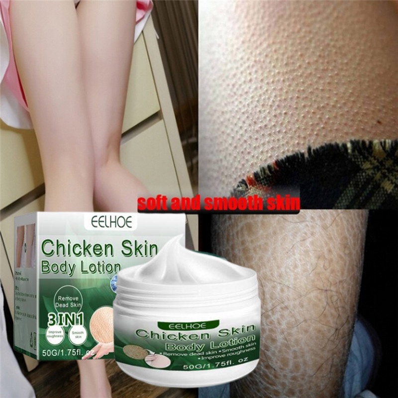 50g Curing Keratosis Pilaris Chicken Skin Body Lotion Skin Repair Cream