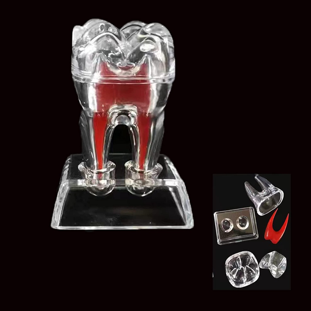 Dental Model Removable Transparent Molar Tooth Anatomy Model For ...