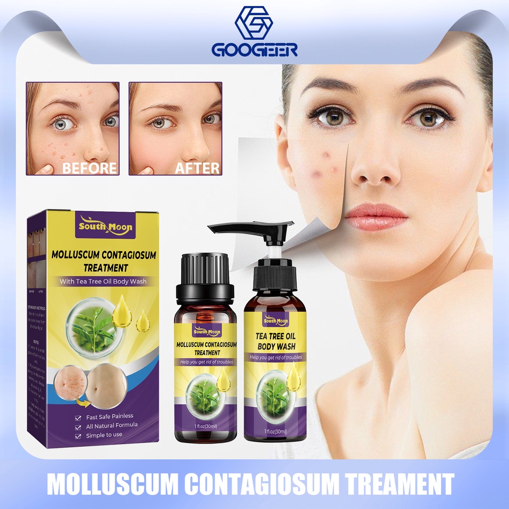 South Moon Molluscum Contagiosum Tea Tree Oil Wart Remover Set Tea Tree Oil Skin Tags Care