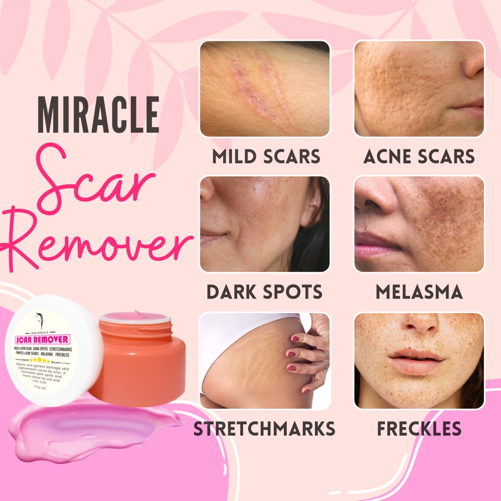 Miracle Scar Remover (Removes Mild Scars, Acne Scars, Dark spots ...