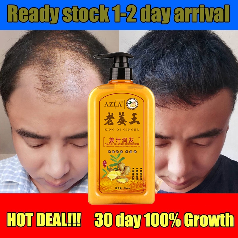 Ginger Hair Shampoo Fast Regrowth Hair Thick Anti-Hair Loss Anti ...