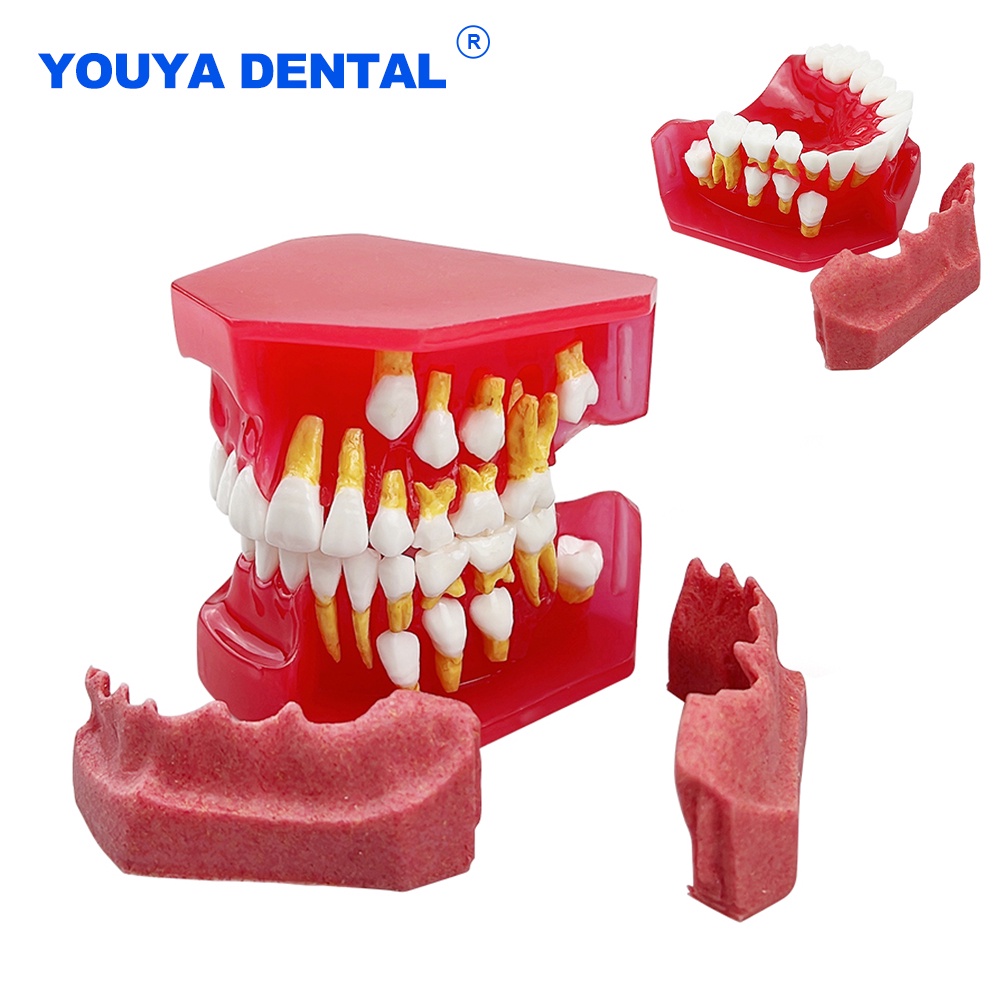 Dental Tooth Model Children Primary Permanent Teeth Alternate Deciduous ...