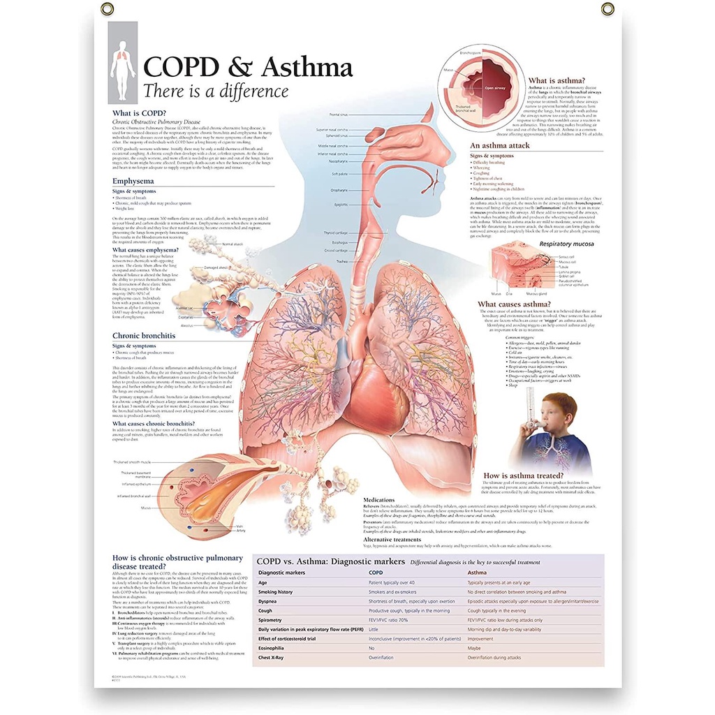 COPD and Asthma Laminated Medical Educational Informational Poster ...