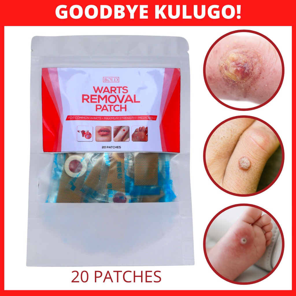 Warts Removal Patch Warts Treatment Painlessly Remove Feet Callus ...