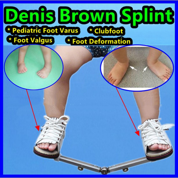 Child Club Foot Disabled Denis Brown Shoe Orthopedic O-leg | Shopee ...