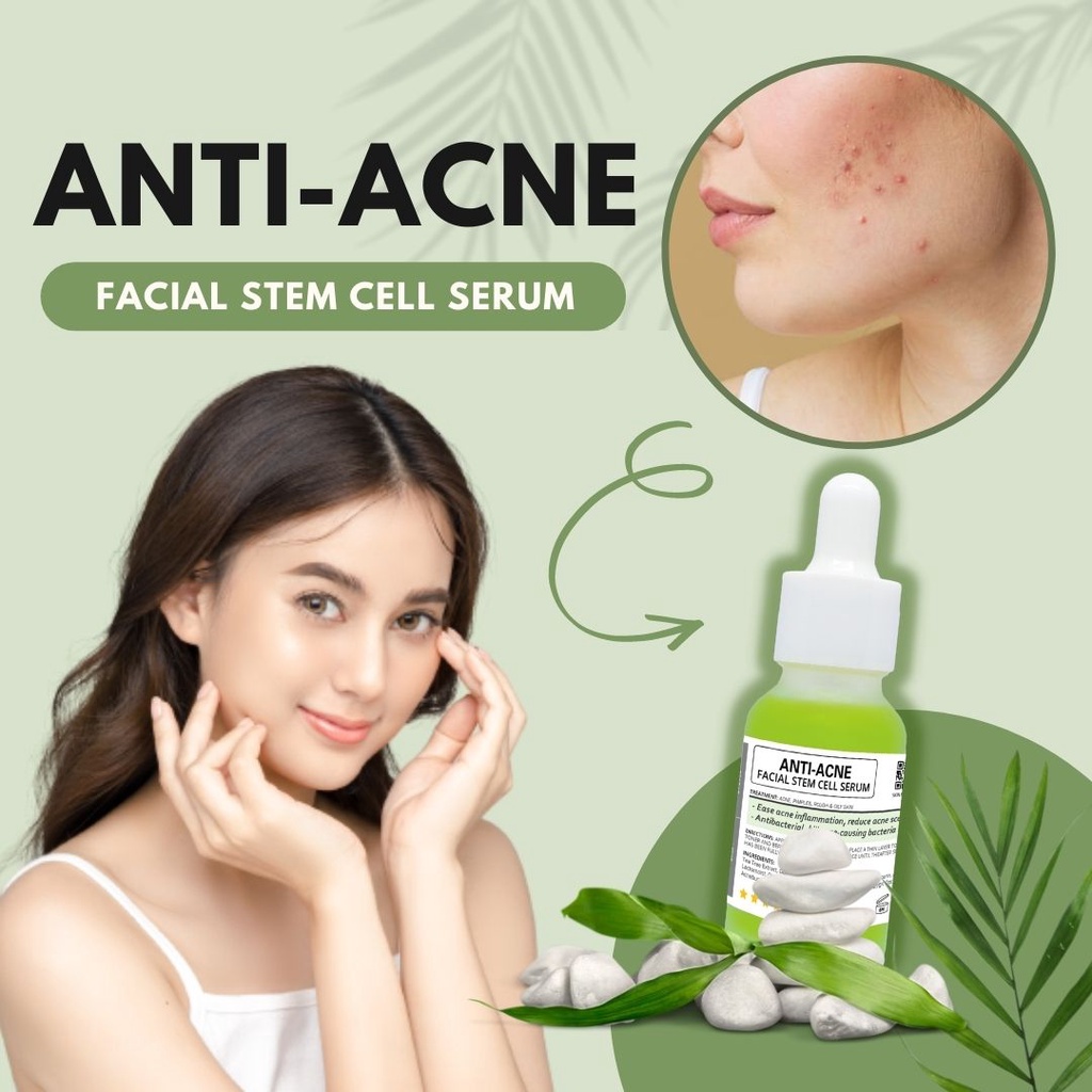 Proven Anti-Acne Facial Stem Cell Serum (Tested to Ease Acne ...