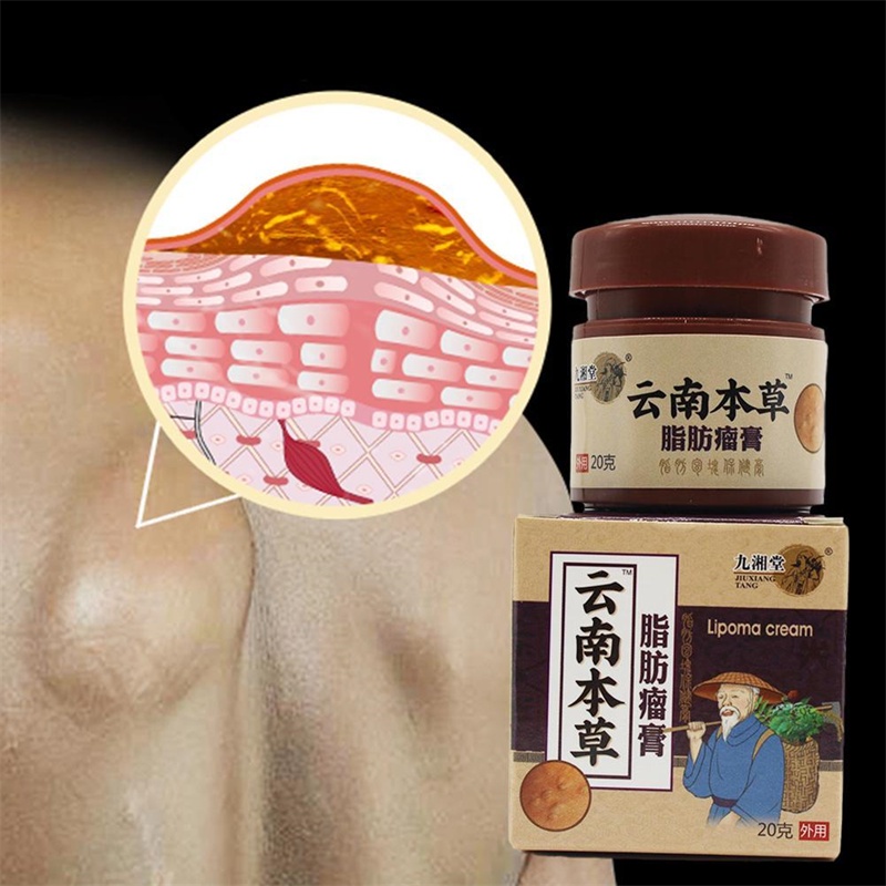 20g Fat Elimination Cream Lipoma Removal Cream Treat Tumor Skin ...