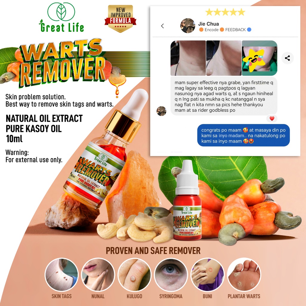 Warts Remover Original Cream Pure Kasoy Oil Pantanggal ng Warts, Nunal ...