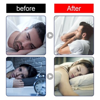 Sleep Patch Relieve Anxiety Stress Headache Sticker Improve Insomnia ...
