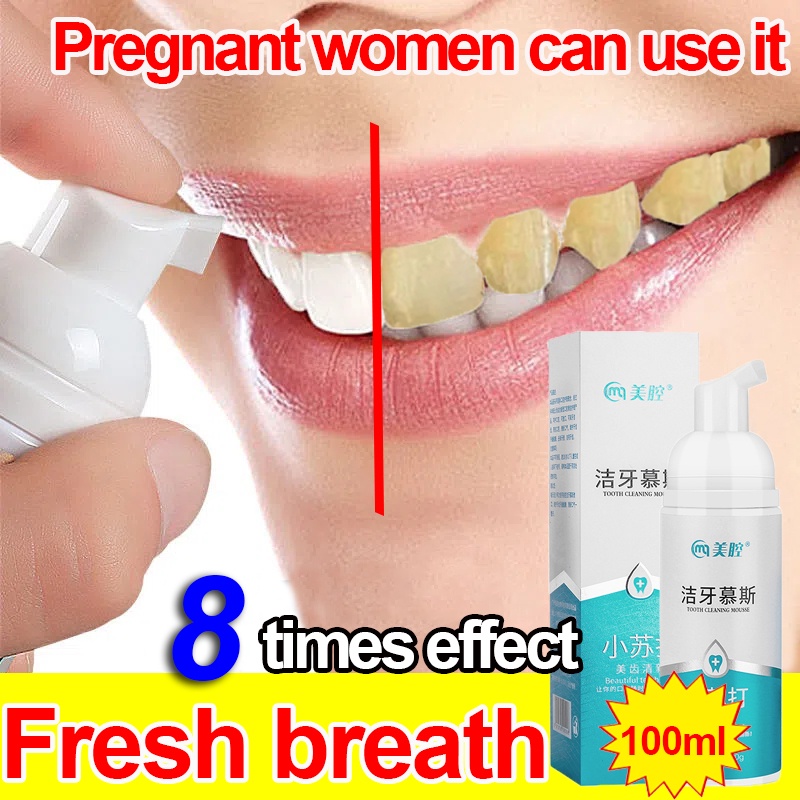 Teeth Whitening 100ml Teeth Cleaner Tartar Remover Teeth Whitening ...