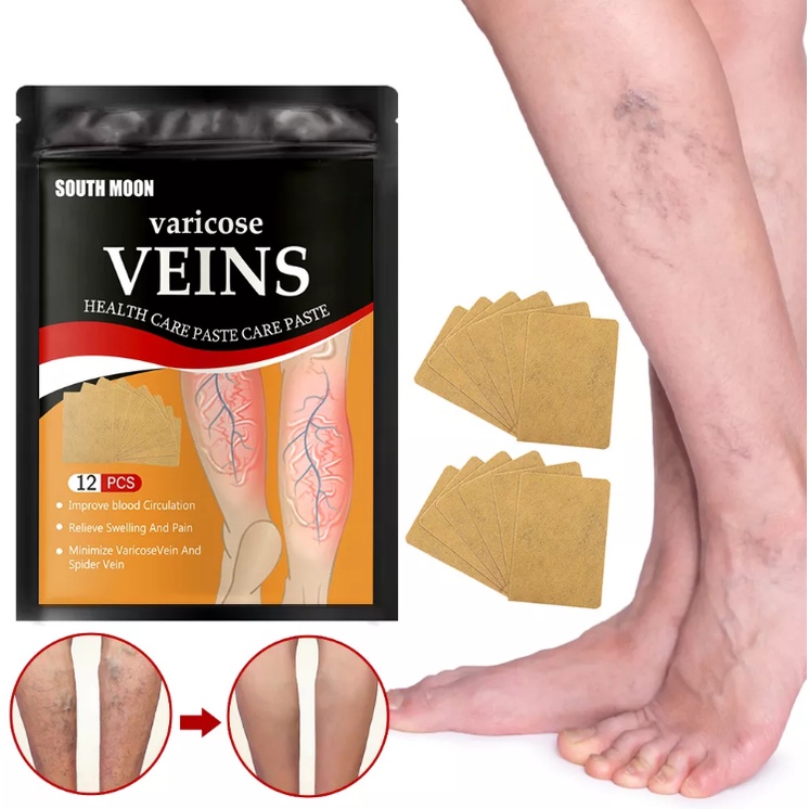 Effective Varicose Vein and Spider Vein Minimizer Patch Improve Blood ...
