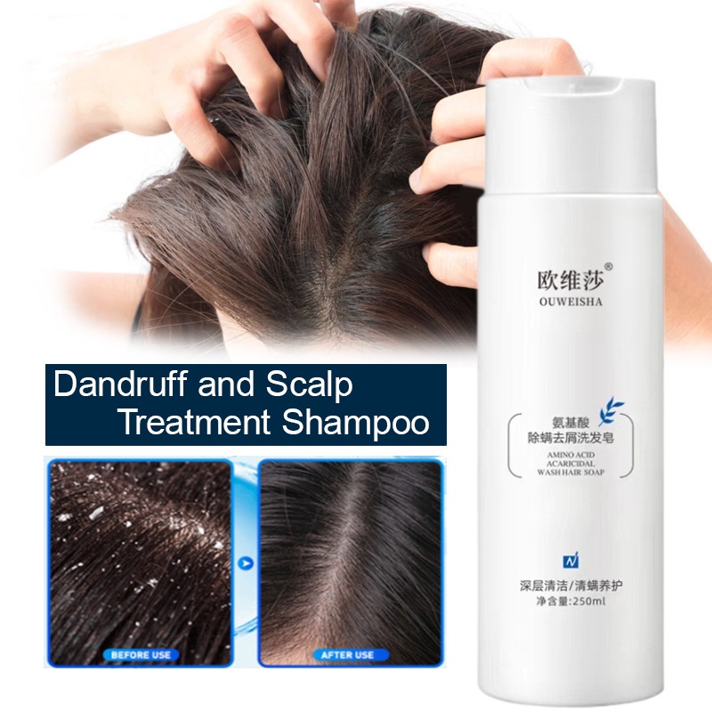 250ml Amino Acid Shampoo Anti-Dandruff Hair Soap Mite Removal Shampoo Itching Relieving oil ...
