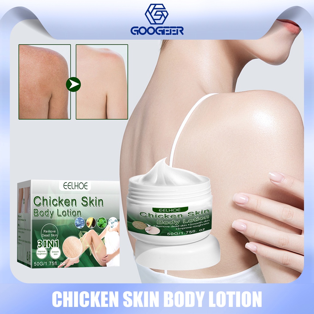 Eelhoe Keratosis Pilaris Repair Cream Chicken Skin Body Lotion Skin