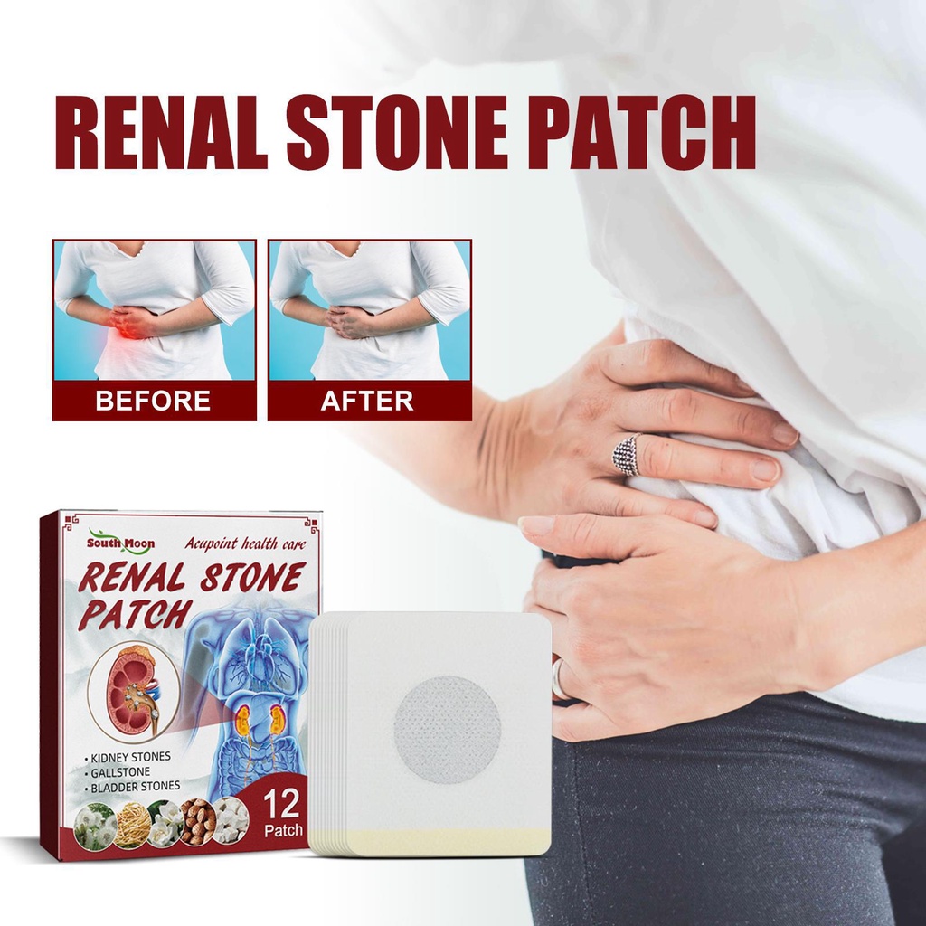 South Moon Renal Stone Patch Renal Pain Relief Patch Chinese Herbal ...