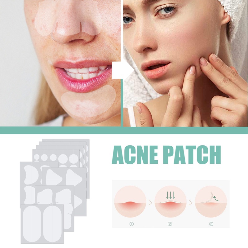 132patches Acne Patch Pimple Patch, 6 Sizes 132 Dot & Nose & T-Zone ...