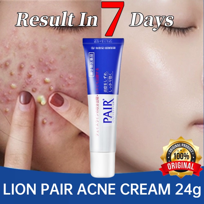 Japan Pair Acne Remover Cream Face Acne Pimple Treatment Skin Repair ...
